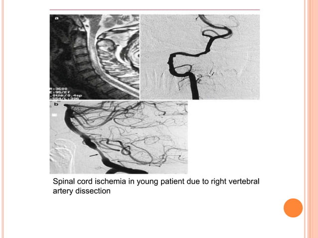 Dissections..intra and extracranila.pptx