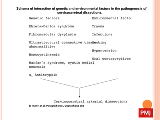Dissections..intra and extracranila.pptx