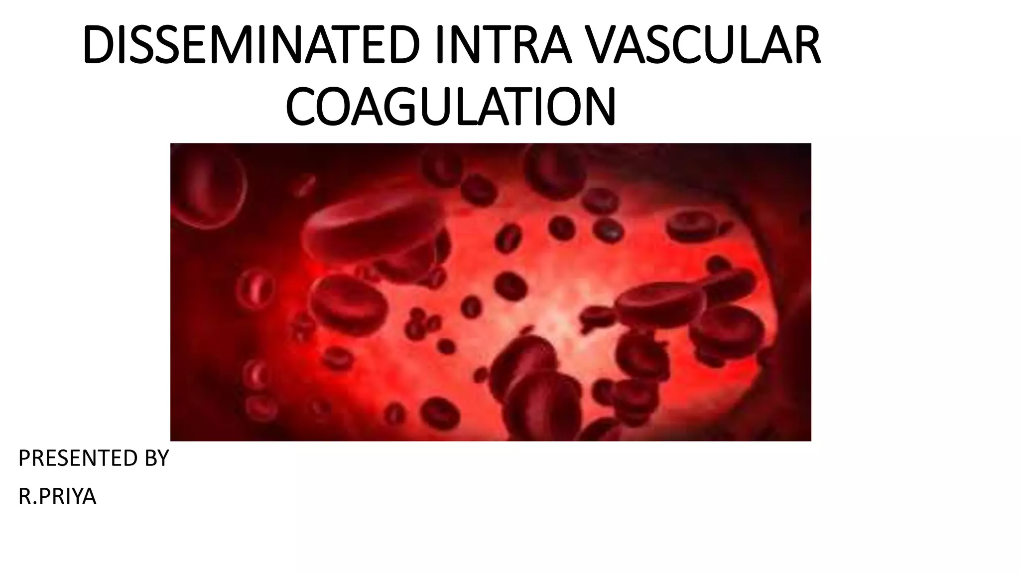 Disseminated intra vascular coagulation | PPTX
