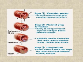 Disseminated intravascular coagulation ppt | PPTX