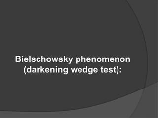 Dissociated Vertical Deviation (DVD) | PPTX