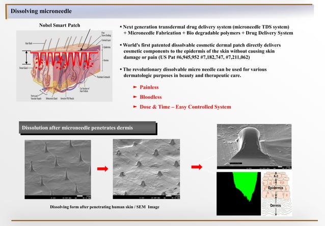 Dissolving microneedle and patch | PDF | Skin Care | Beauty