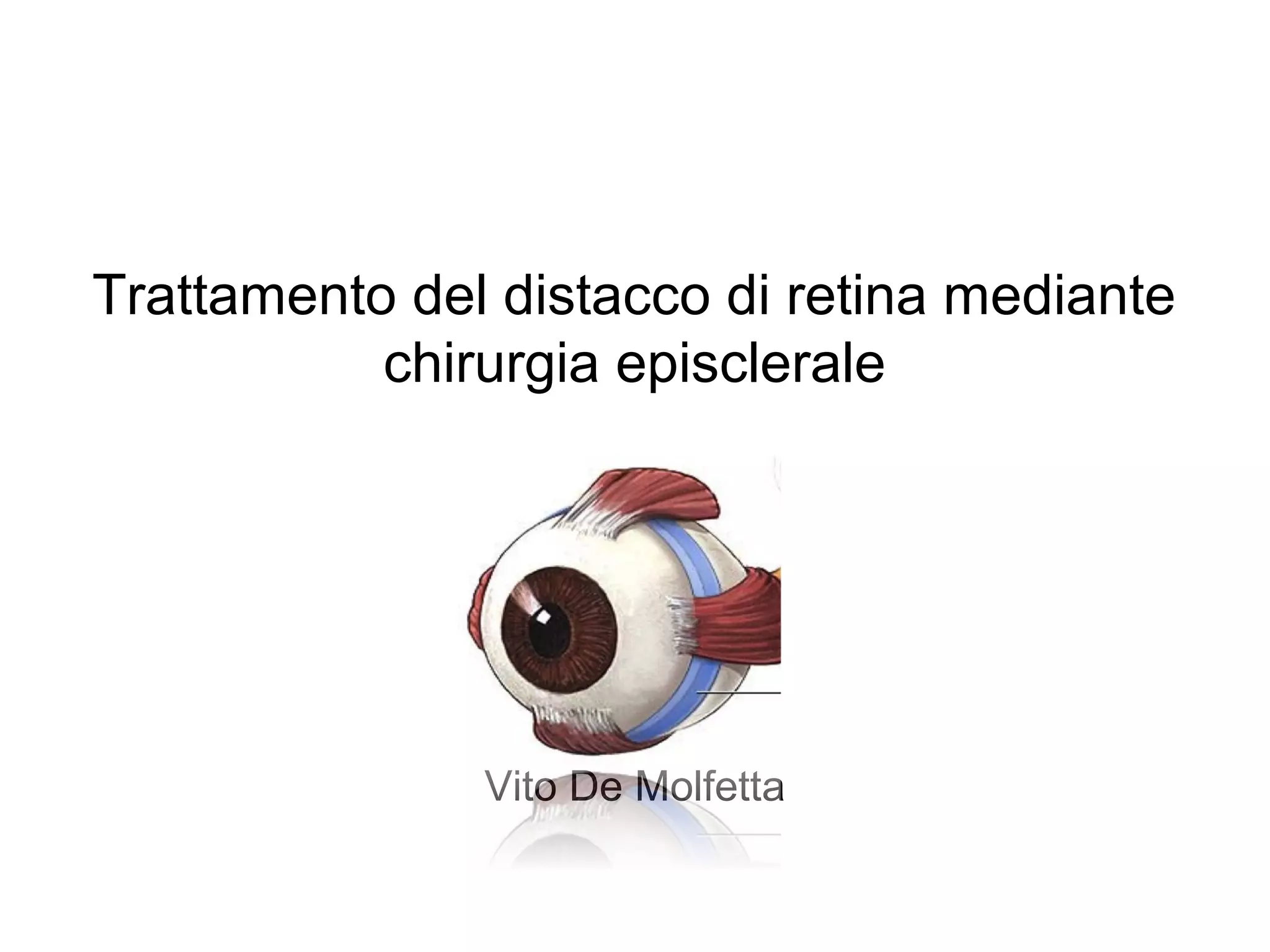 Distacco retina tecnica episclerale 2011 | PPT | Eye and Vision ...
