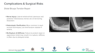 Distal Biceps Avulsion presentation and treatment options | PDF