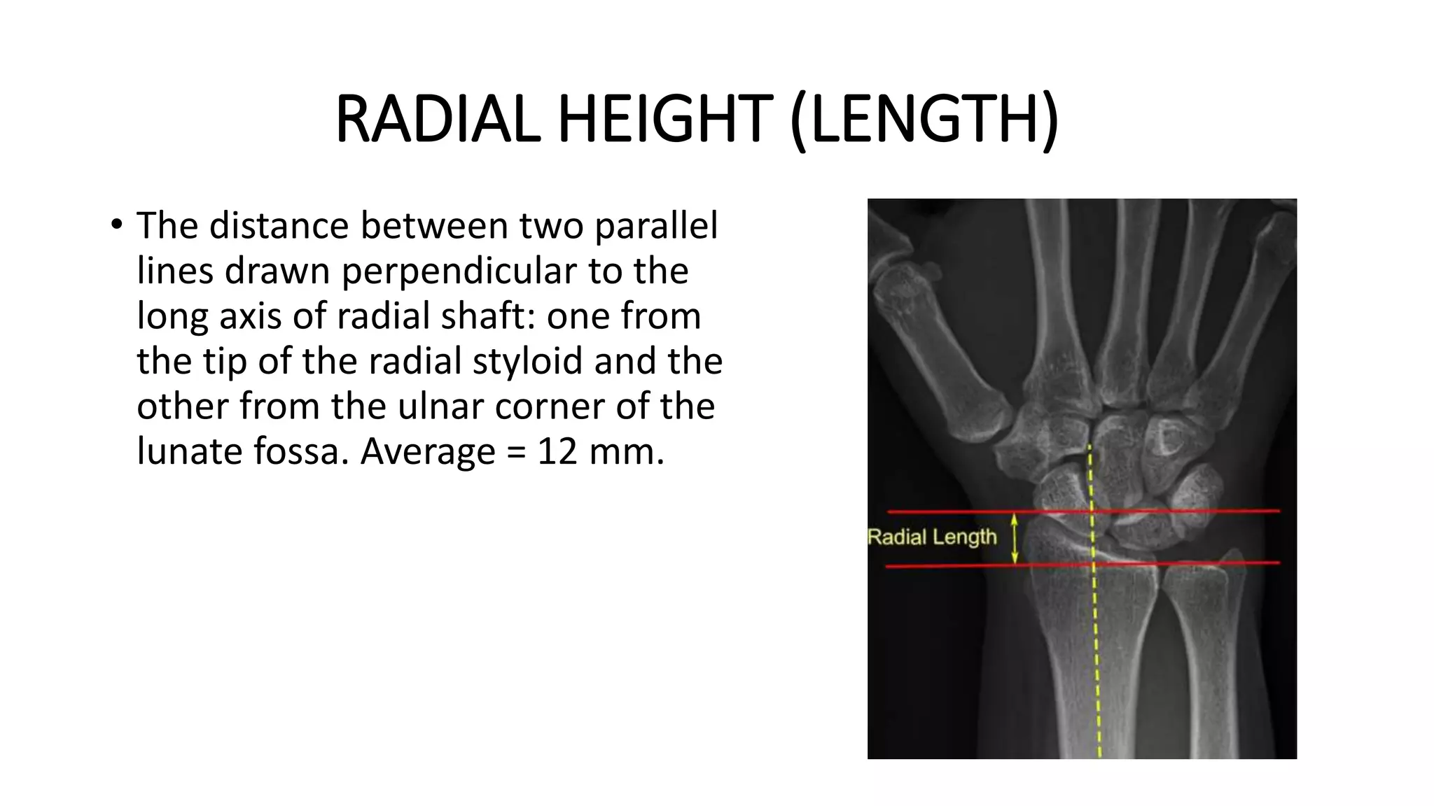 DISTAL END OF RADIUS FRACTURE AND DISLOCATION MANAGEMENT.pptx