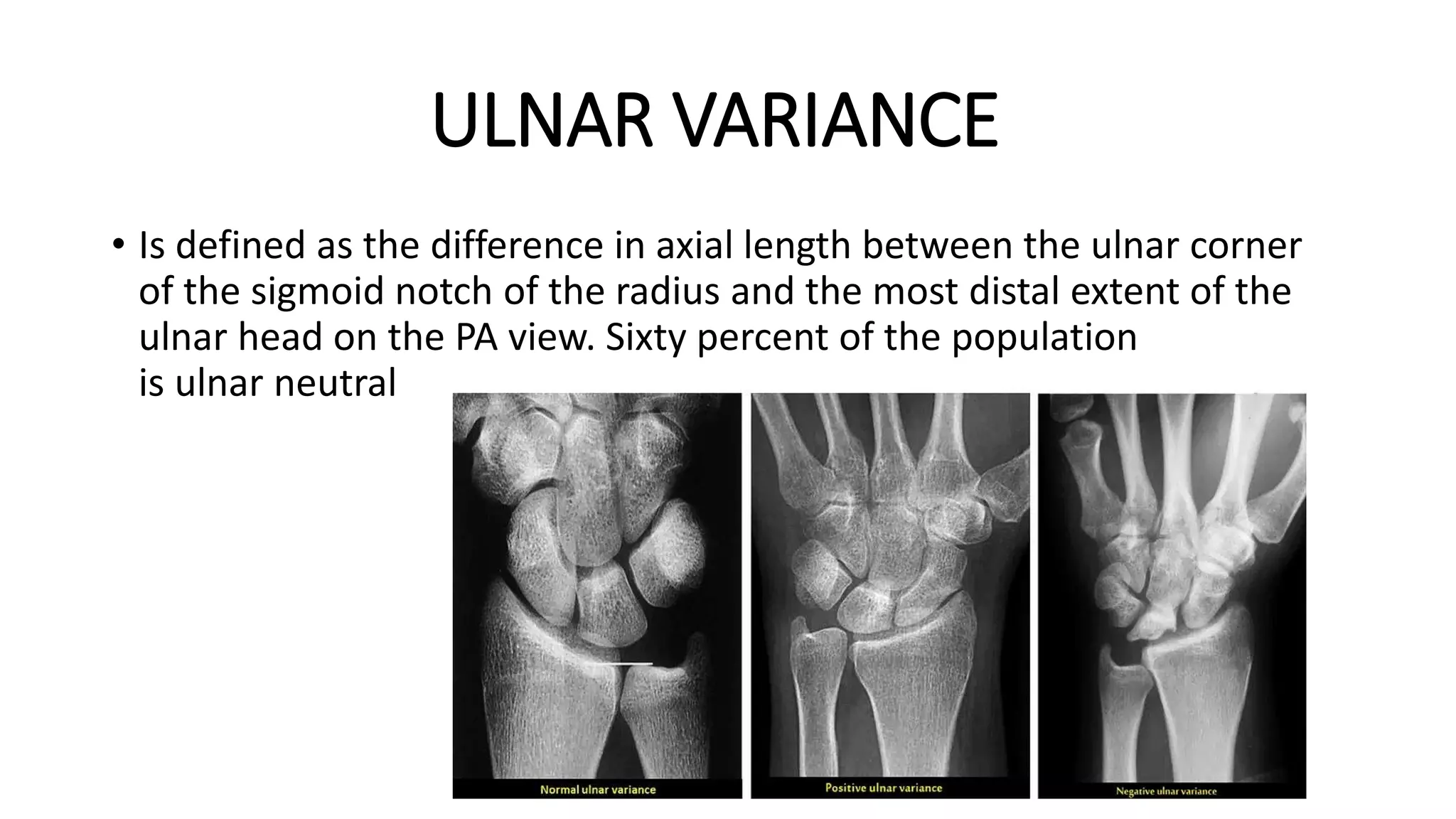 DISTAL END OF RADIUS FRACTURE AND DISLOCATION MANAGEMENT.pptx