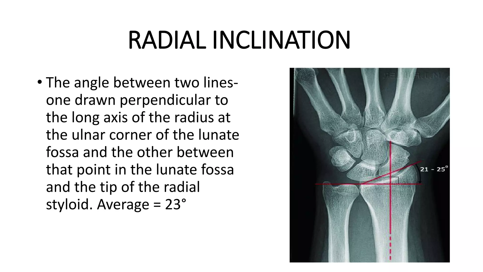 DISTAL END OF RADIUS FRACTURE AND DISLOCATION MANAGEMENT.pptx