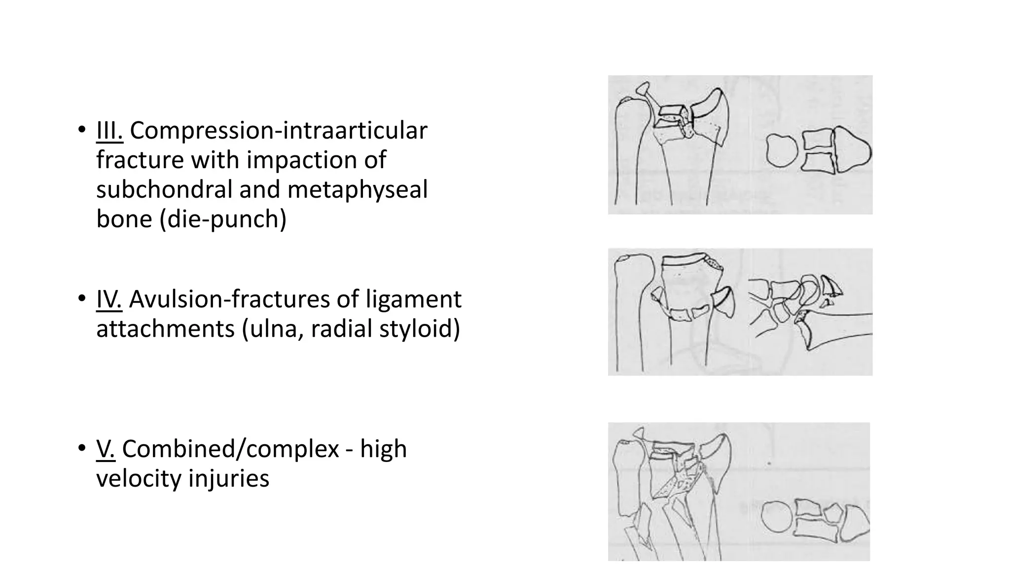 DISTAL END OF RADIUS FRACTURE AND DISLOCATION MANAGEMENT.pptx