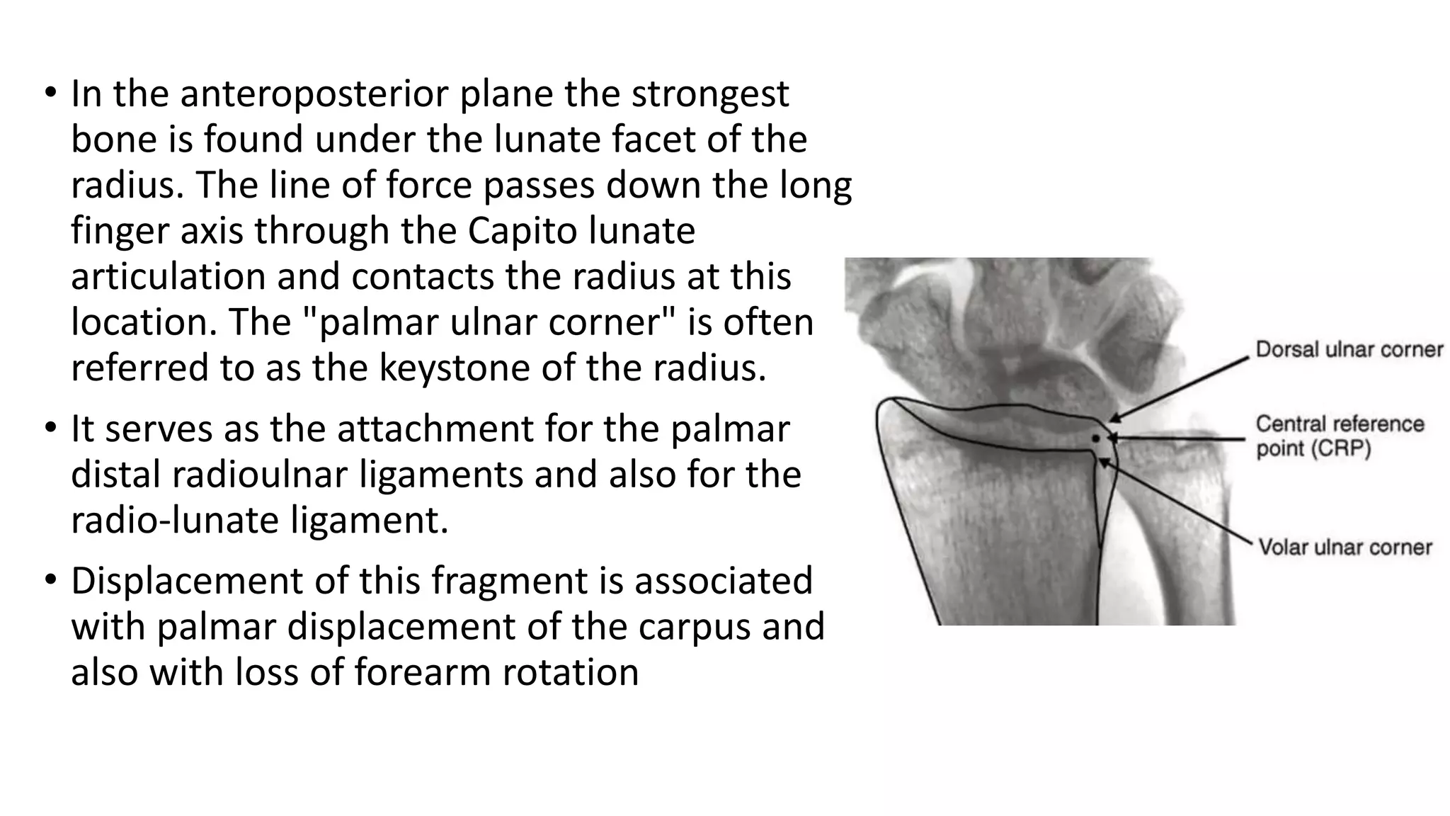 DISTAL END OF RADIUS FRACTURE AND DISLOCATION MANAGEMENT.pptx