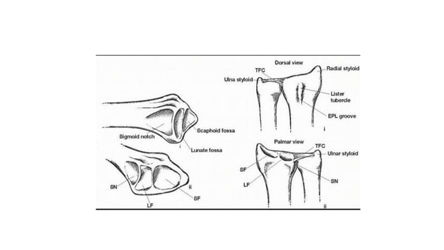 DISTAL END OF RADIUS FRACTURE AND DISLOCATION MANAGEMENT.pptx | Death ...
