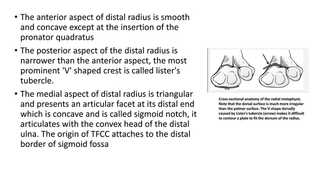 DISTAL END OF RADIUS FRACTURE AND DISLOCATION MANAGEMENT.pptx | Death ...