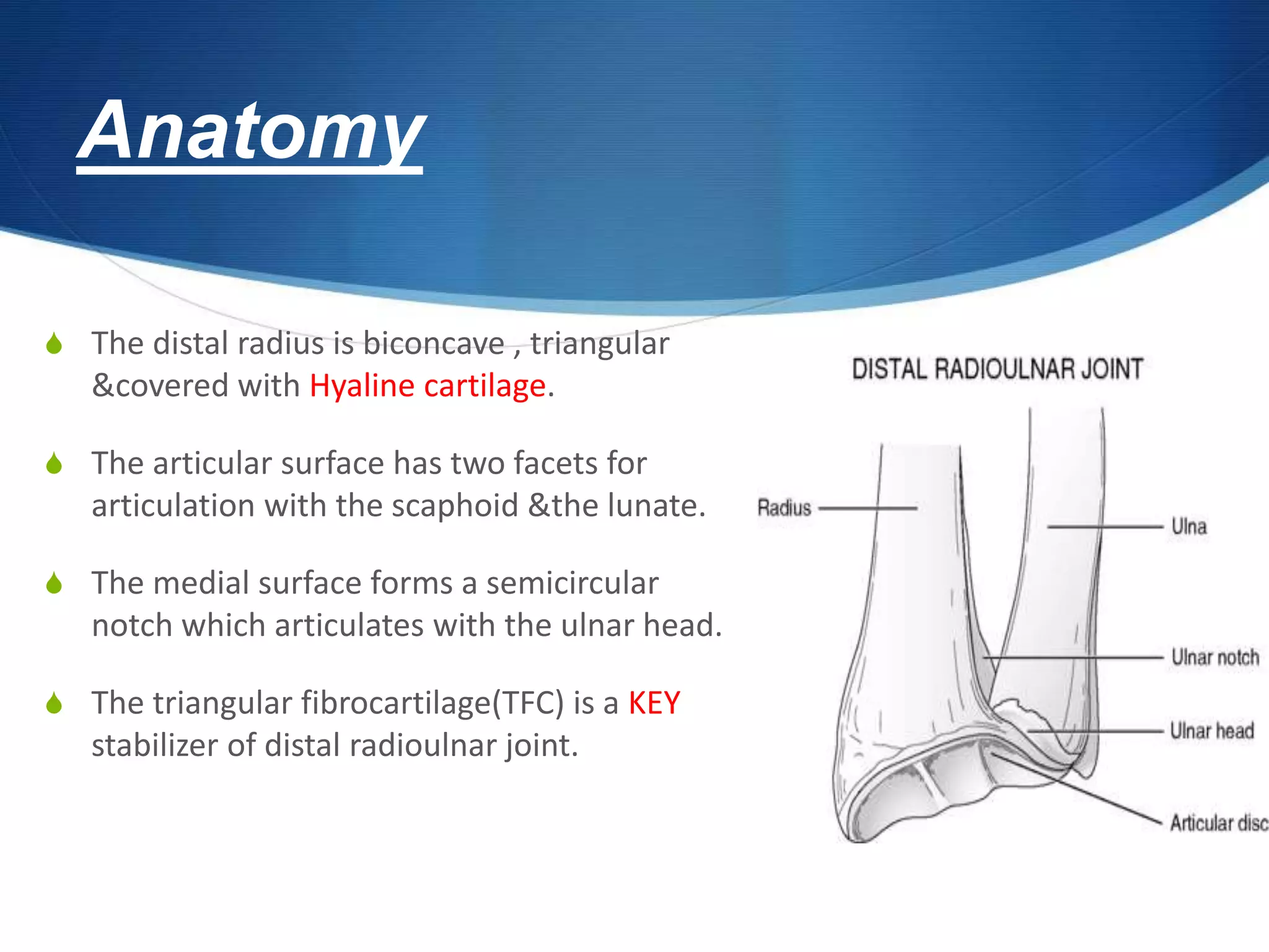 Ulnar Notch Of Radius Fracture