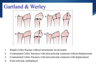 Distal end of radius fractures dr.harish | PPTX