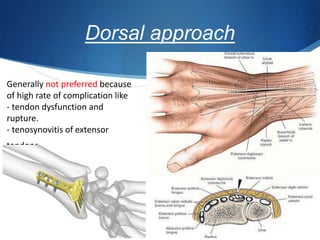 Distal end of radius fractures dr.harish | PPTX
