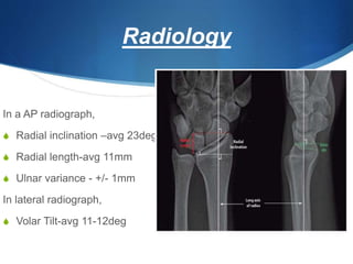 Distal end of radius fractures dr.harish | PPTX