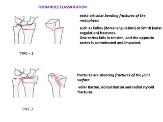 Distal end radius fracture | PPTX