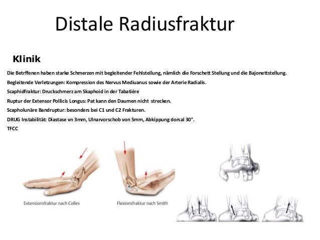 Distale radius fraktur
