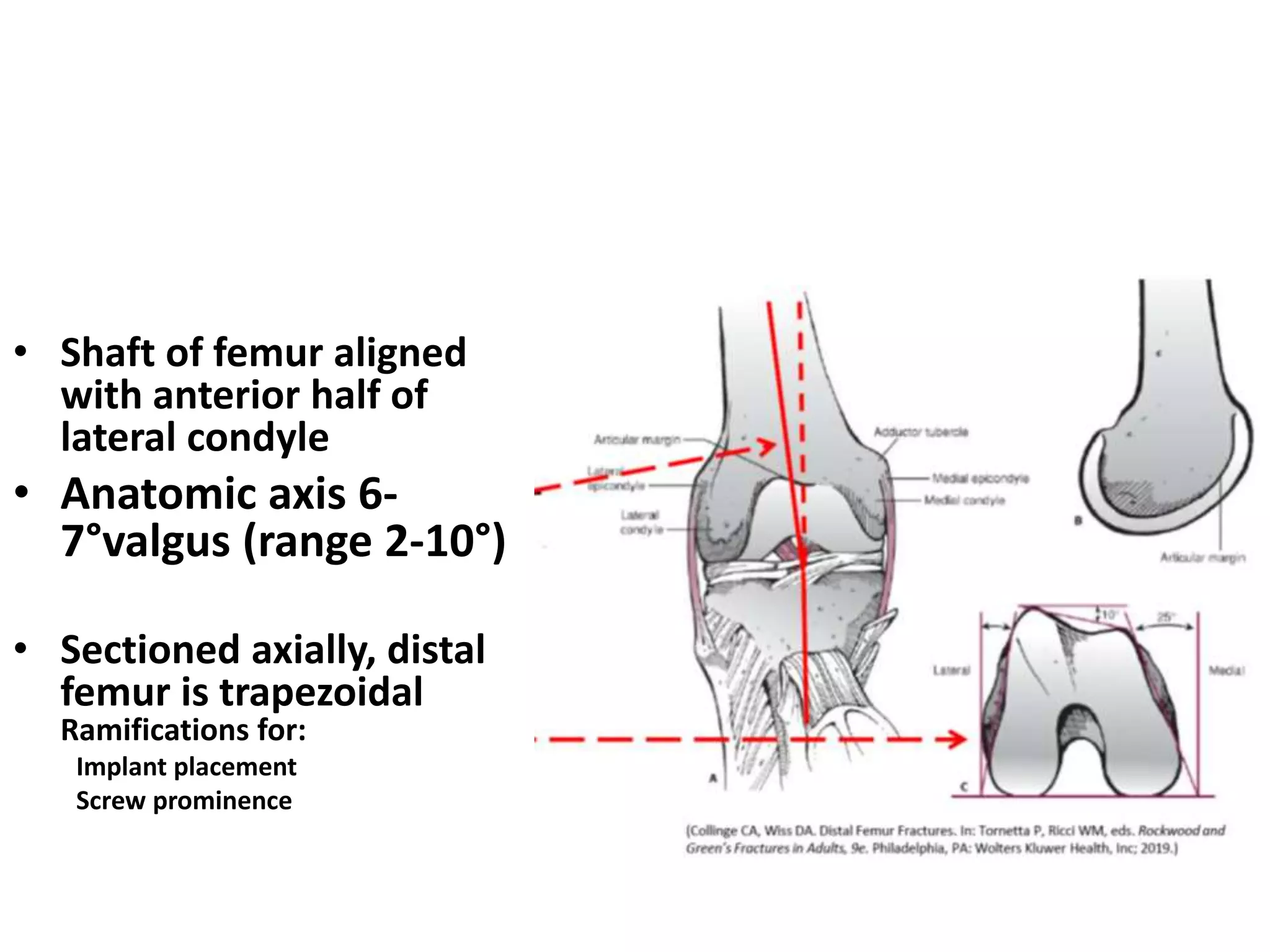 distal femoral fx2.pptx