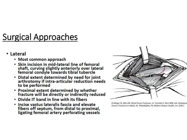 distal femoral fx2.pptx | First Aid | Injuries