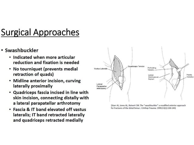 distal femoral fx2.pptx | First Aid | Injuries