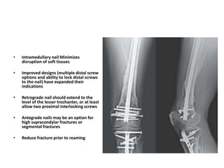 distal femoral fx2.pptx