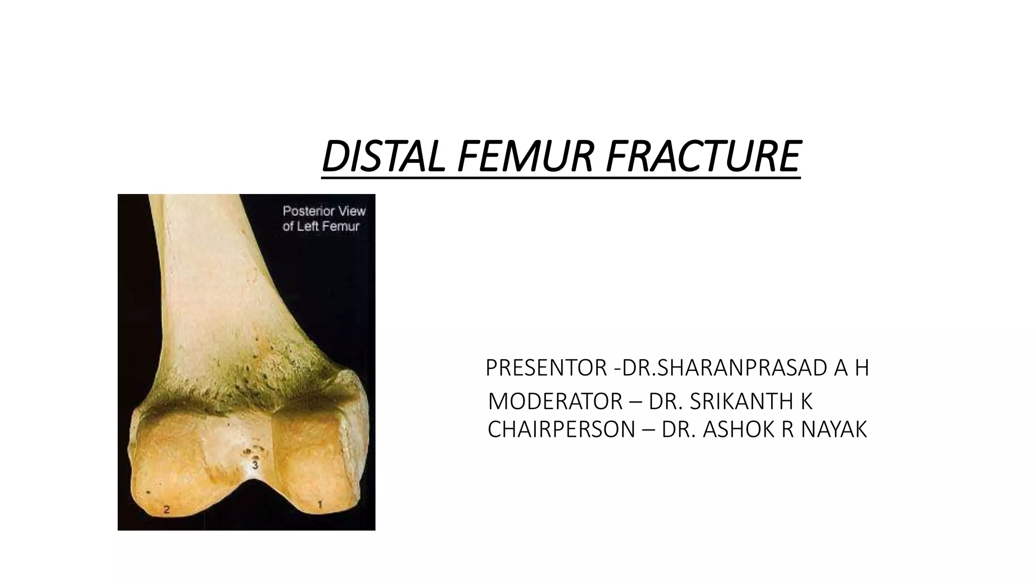 Distal femur fracture | PPTX