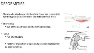 Distal Femur fracture fixation along surgical approach | PPTX