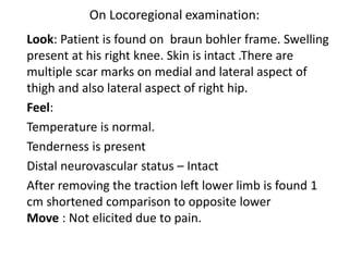 distal femrcrcrcfecrcffgftftftftgtur anwar.pptx