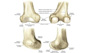 distal femur fractures classification with treatment | PPTX