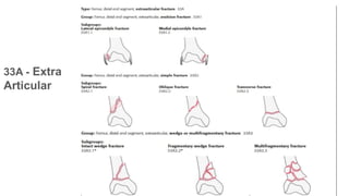 distal femur fractures classification with treatment | PPTX
