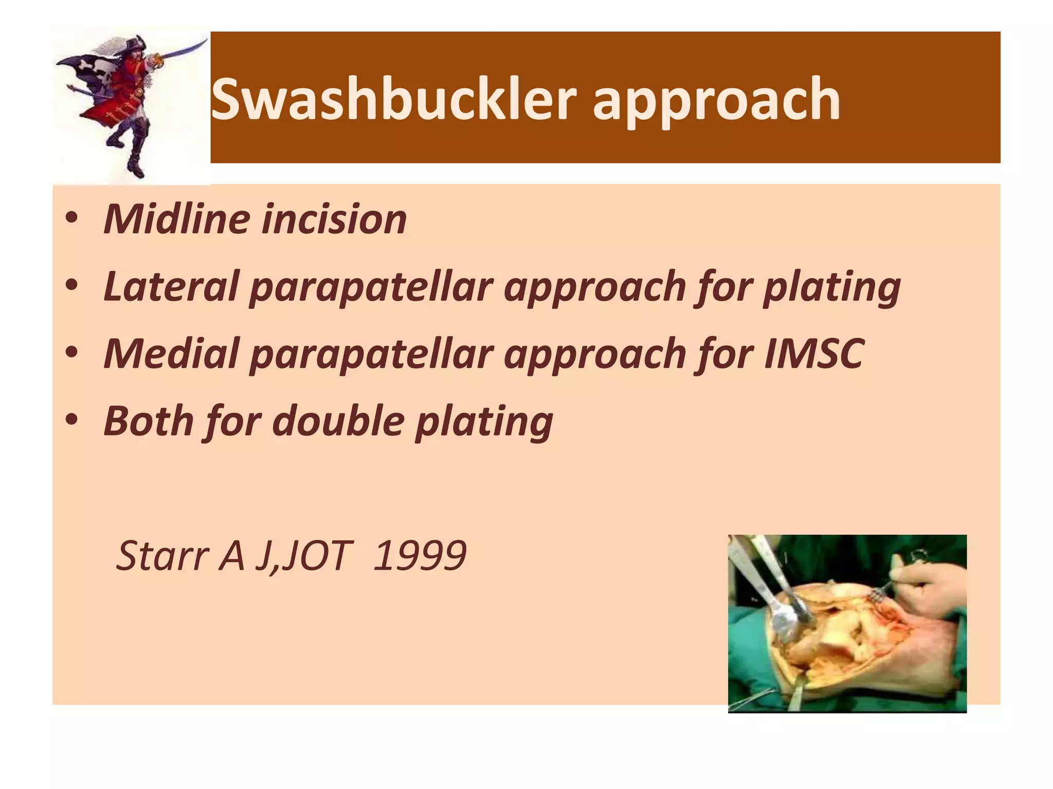 Distal femur fractures what makes it complex ,dr mohamed ashraf,hod ...