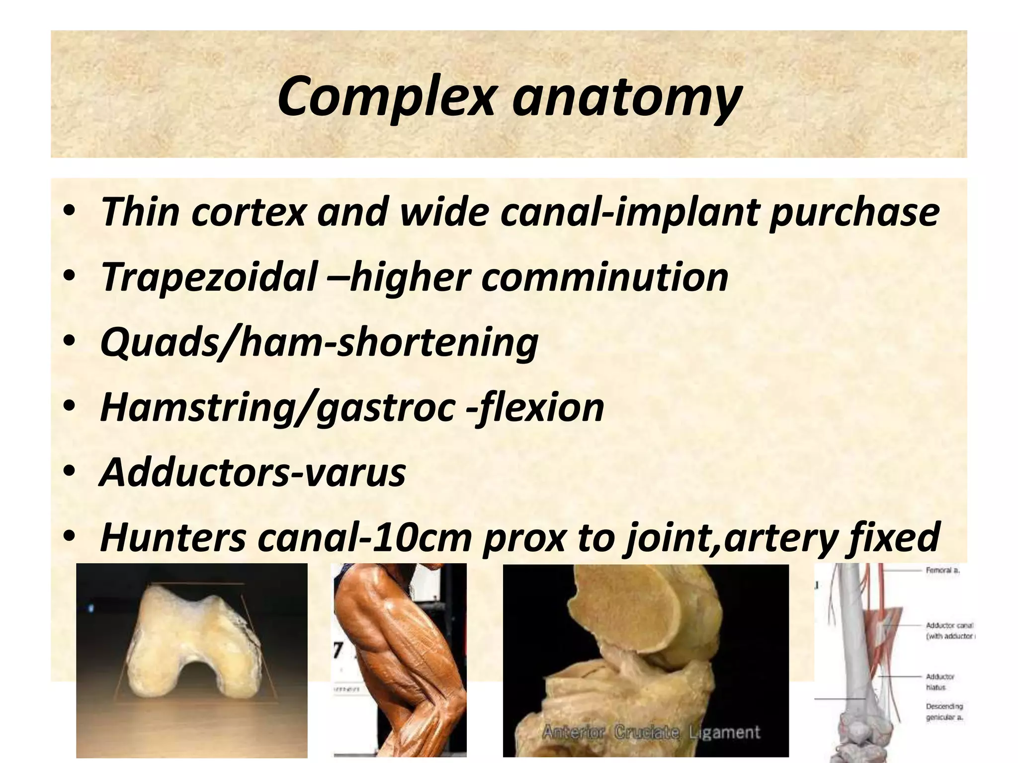 Distal femur fractures what makes it complex ,dr mohamed ashraf,hod ...