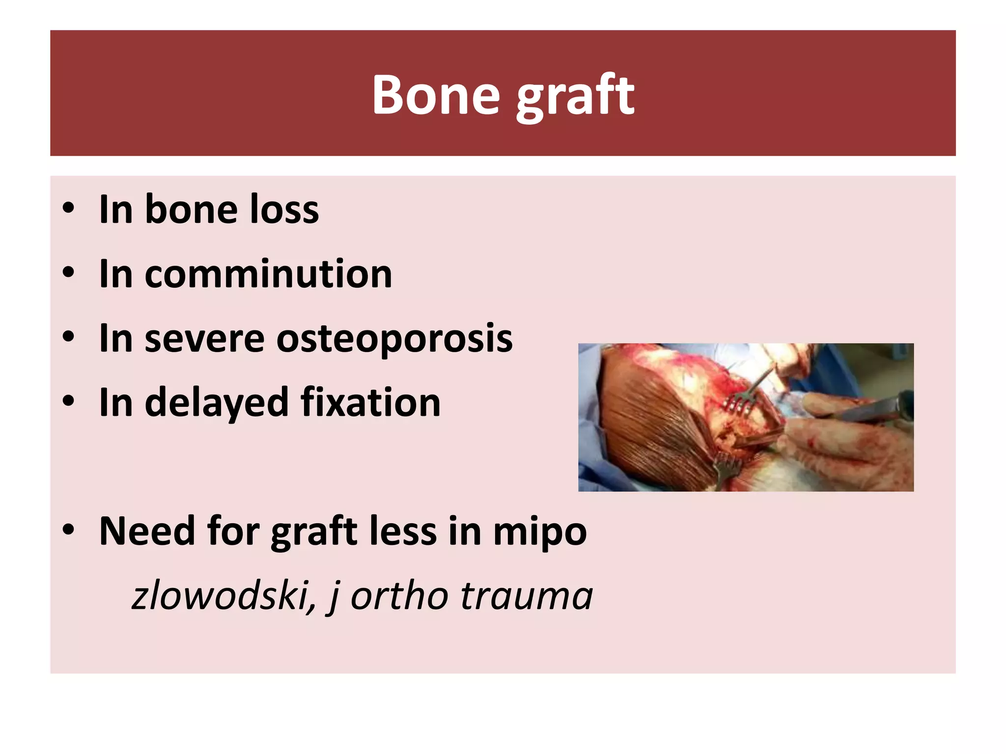 Distal femur fractures what makes it complex ,dr mohamed ashraf,hod ...