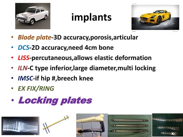 Distal femur fractures what makes it complex ,dr mohamed ashraf,hod ...
