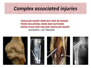 Distal femur fractures what makes it complex ,dr mohamed ashraf,hod ...