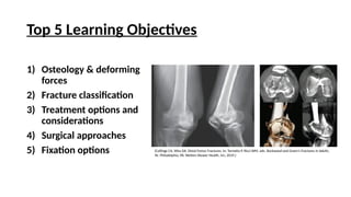 Distal Femur Fractures (1).pptxwell explained | PPTX