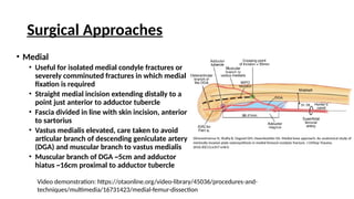 Distal Femur Fractures (1).pptxwell explained | PPTX