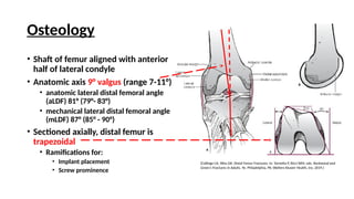 Distal Femur Fractures (1).pptxwell explained | PPTX