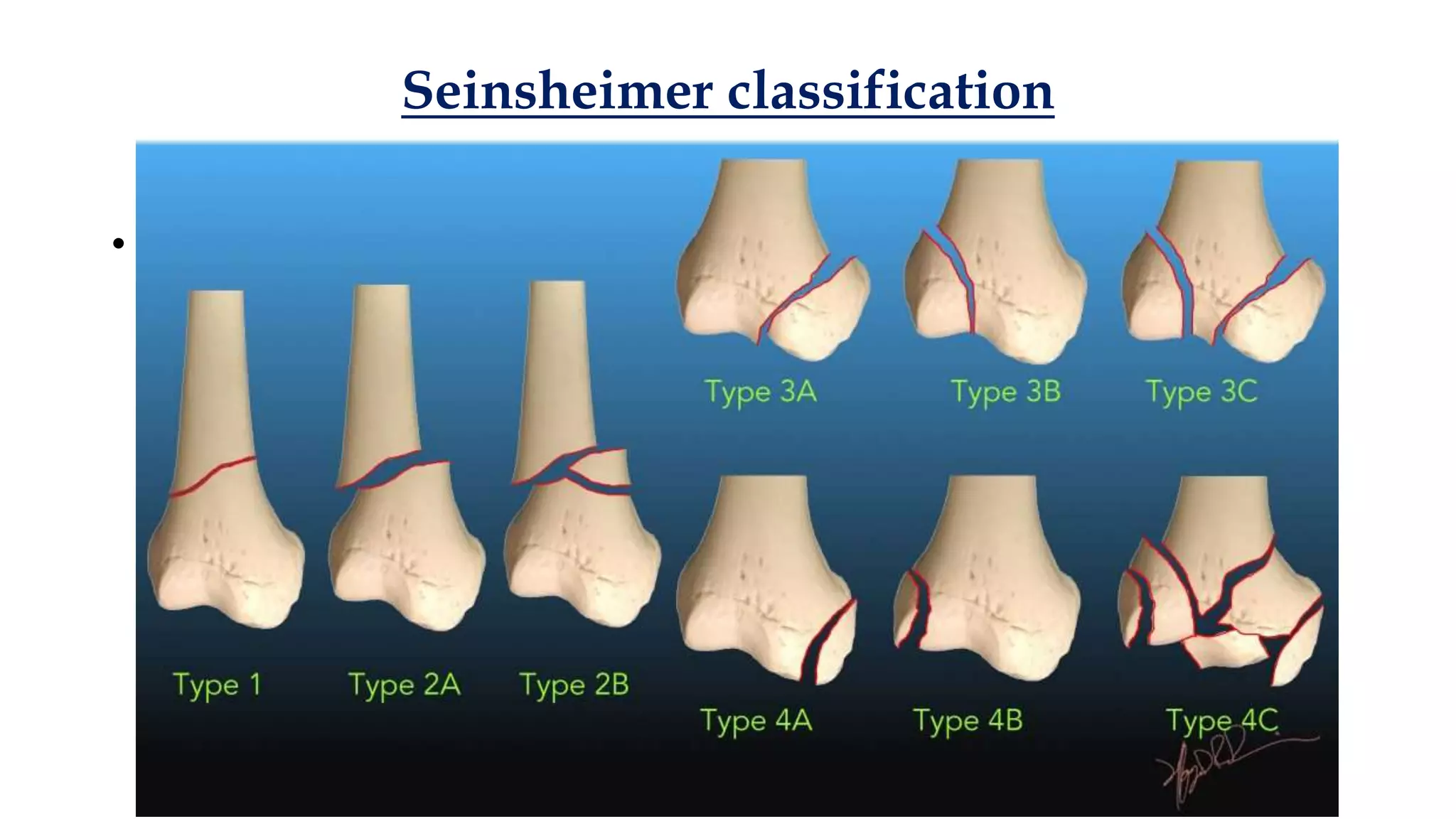 Distal femur fractures dr.shubham.pptx