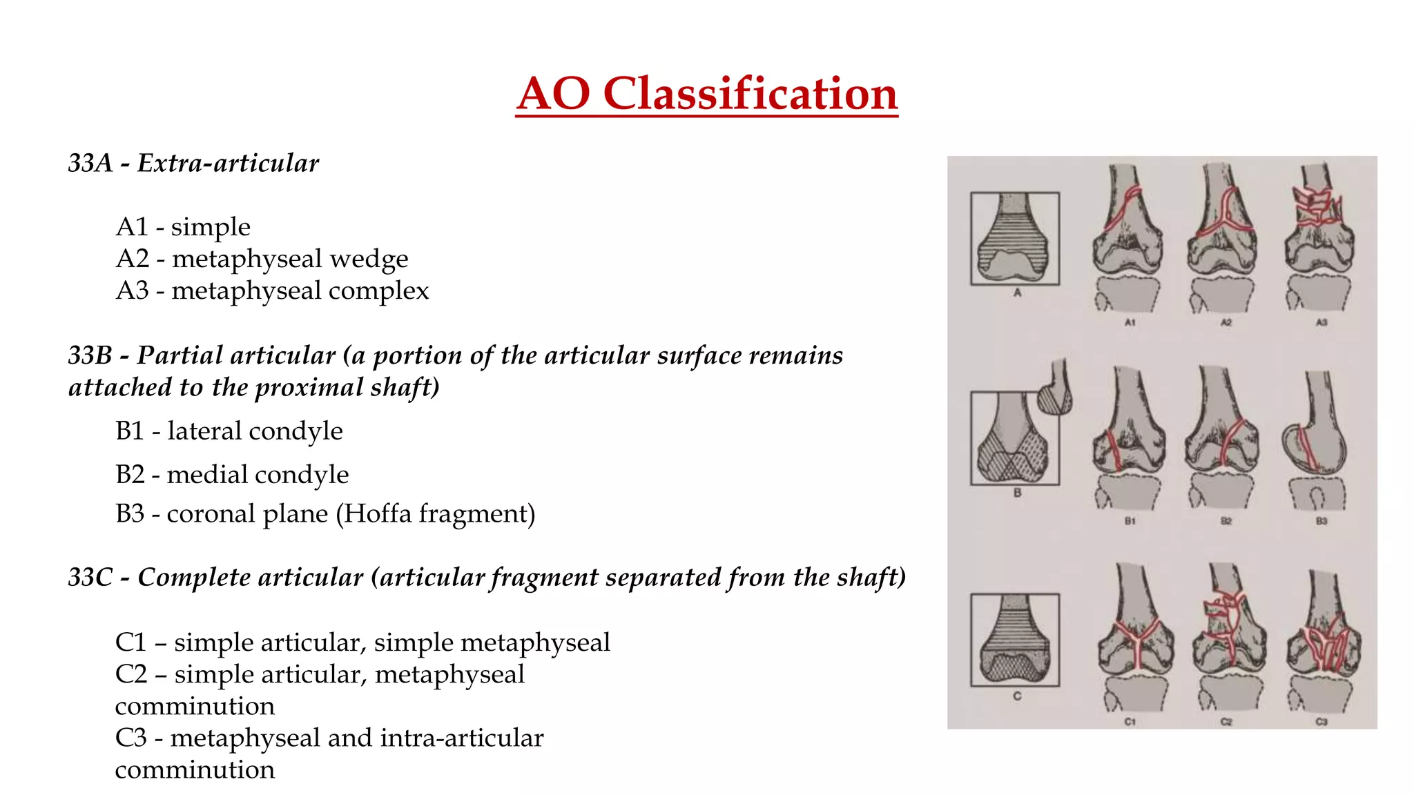 Distal femur fractures dr.shubham.pptx