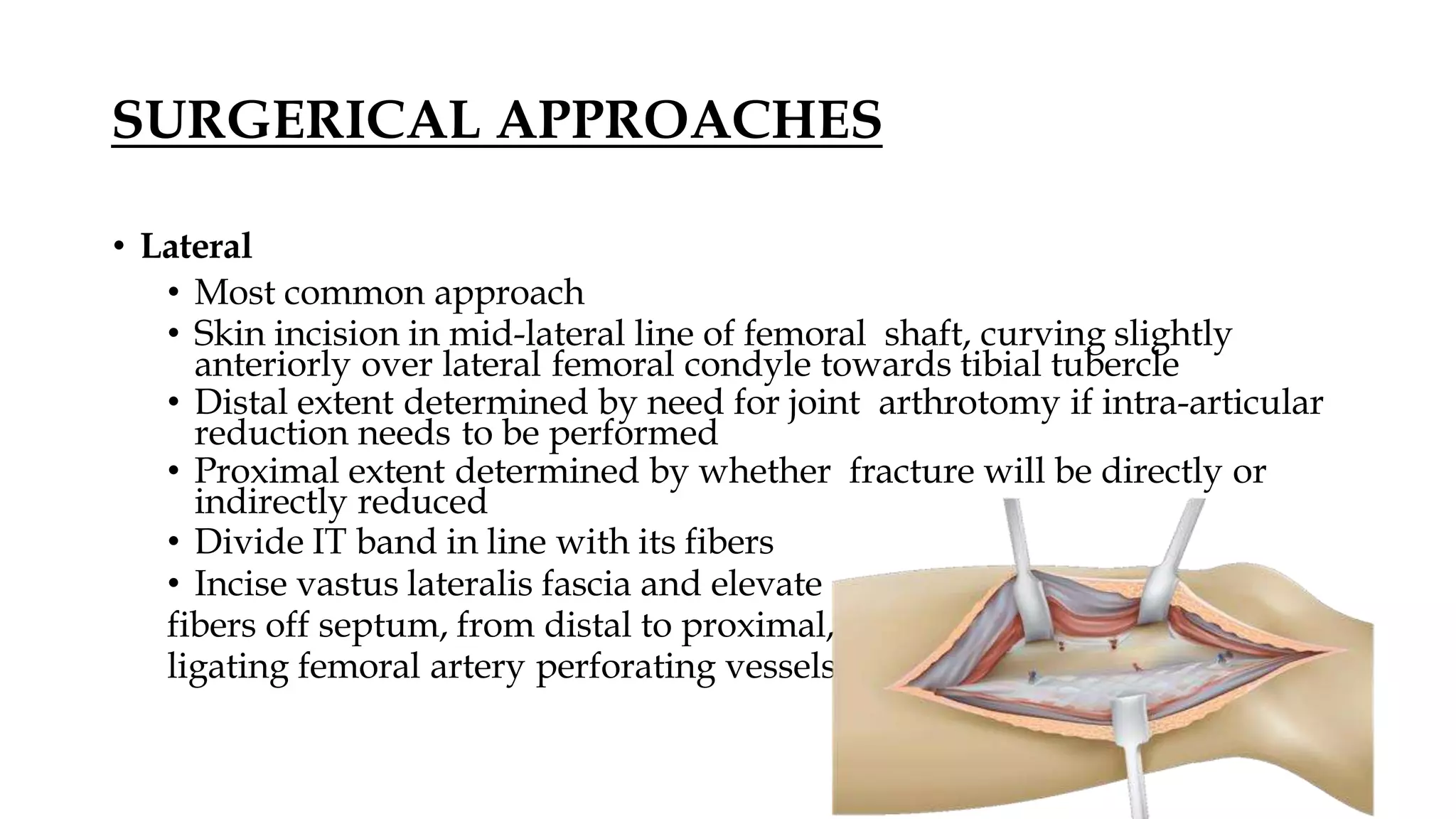 Distal femur fractures dr.shubham.pptx