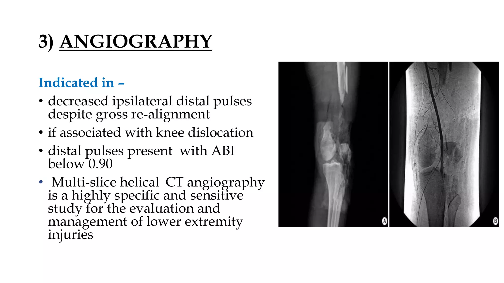 Distal femur fractures dr.shubham.pptx
