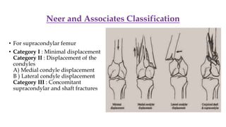 Distal femur fractures dr.shubham.pptx
