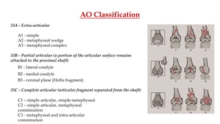 Distal femur fractures dr.shubham.pptx