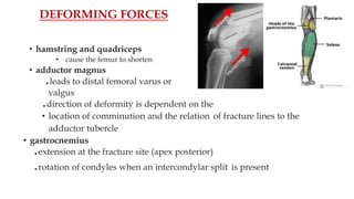 Distal femur fractures dr.shubham.pptx