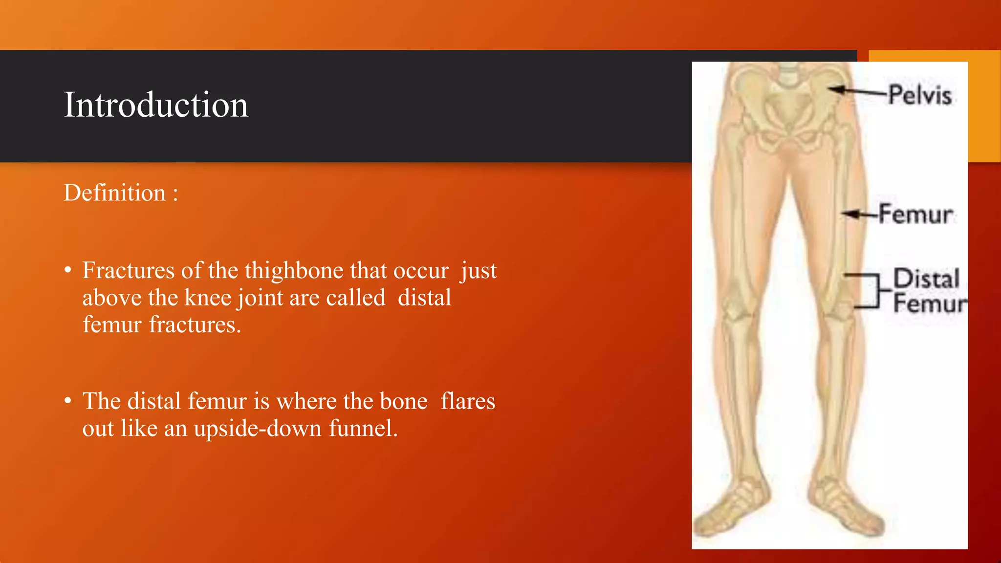 Distal femur fractures & fracture patella by dr ashutosh | PPTX