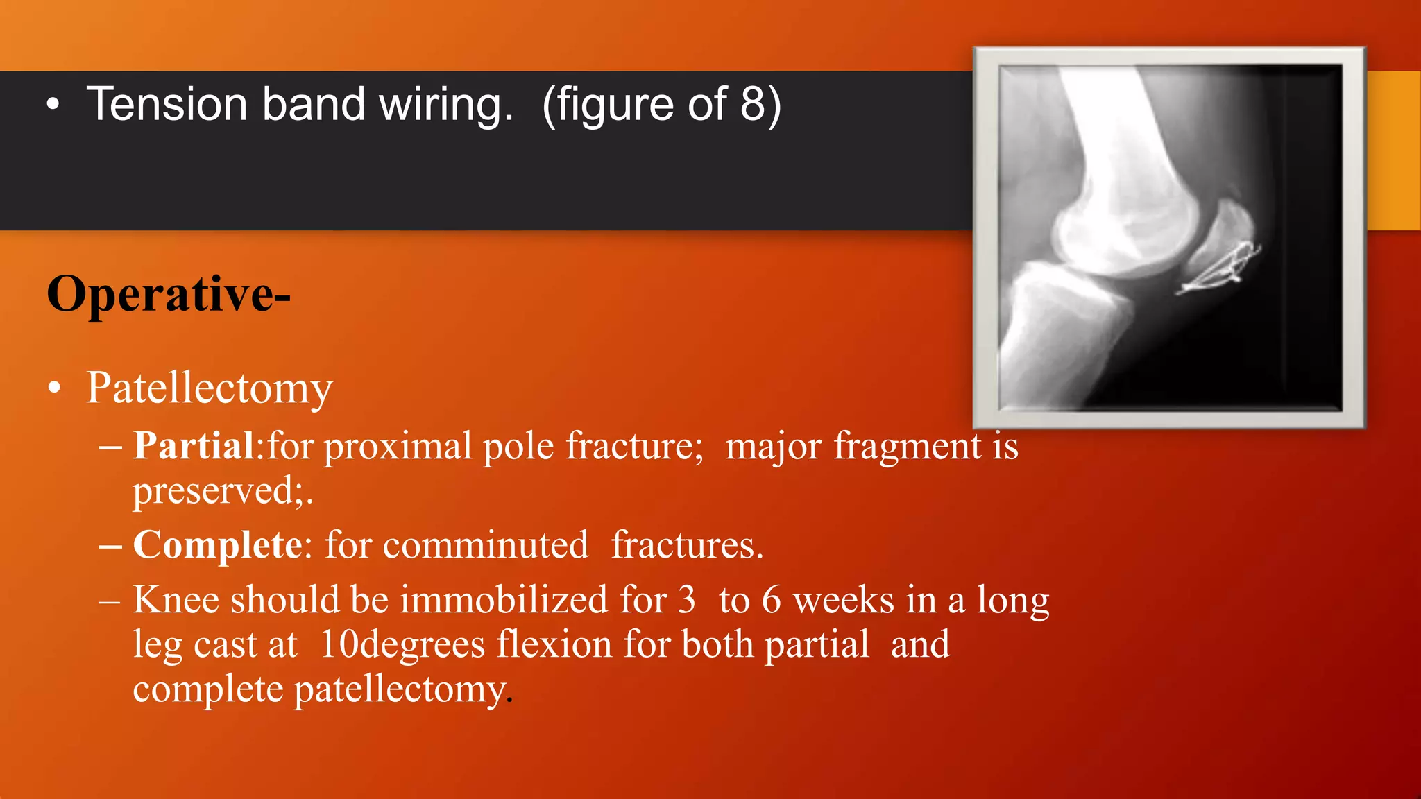 Distal femur fractures & fracture patella by dr ashutosh | PPTX