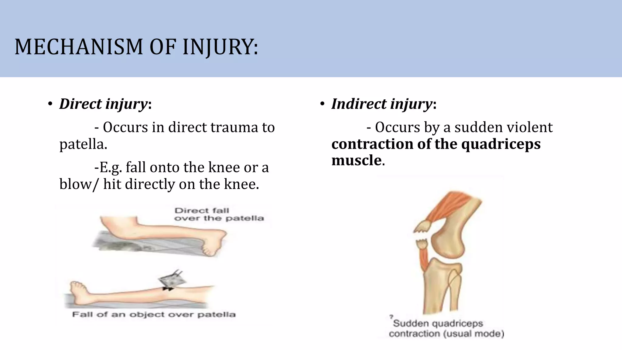 DISTAL FEMUR, PATELLA, PROXIMAL TIBIA FRACTURE.pptx