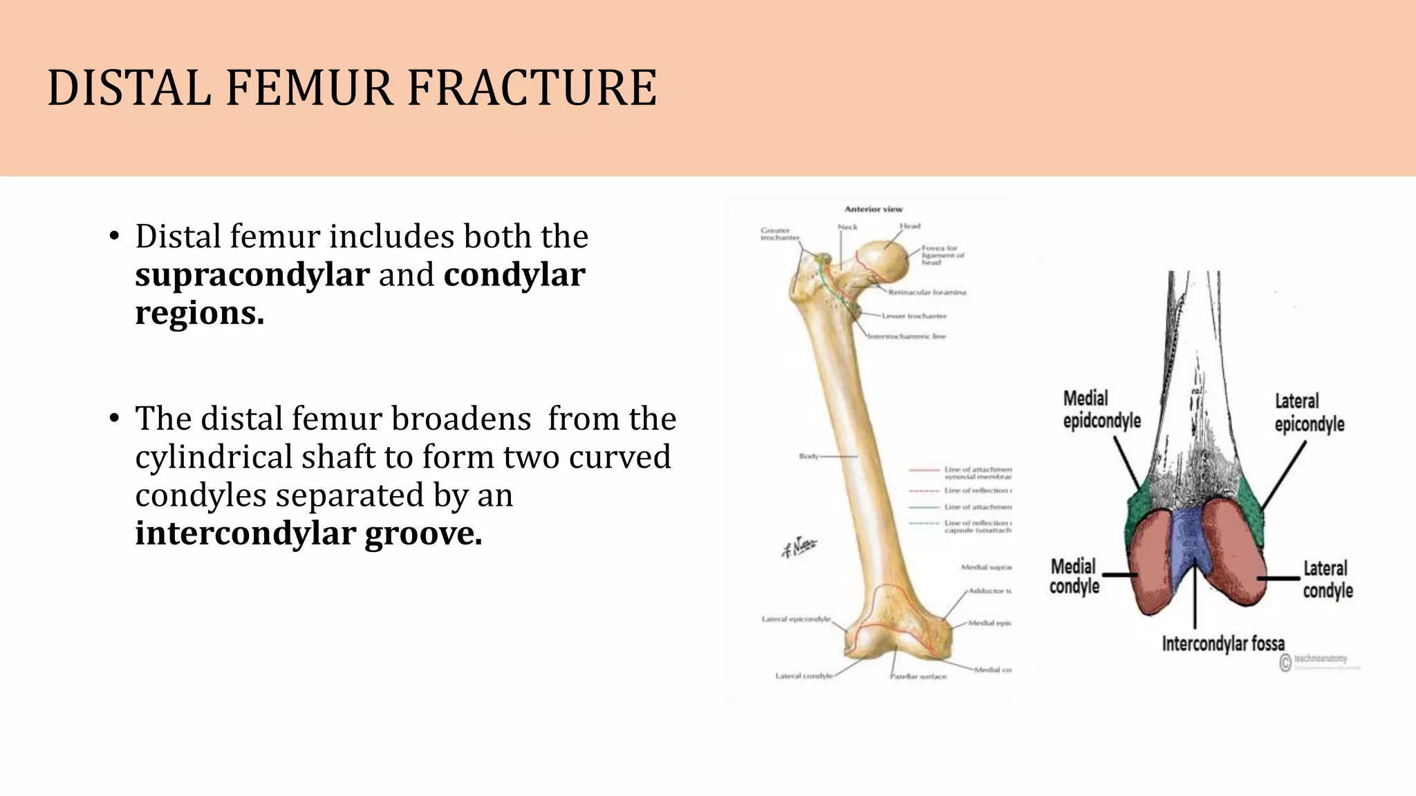 DISTAL FEMUR, PATELLA, PROXIMAL TIBIA FRACTURE.pptx