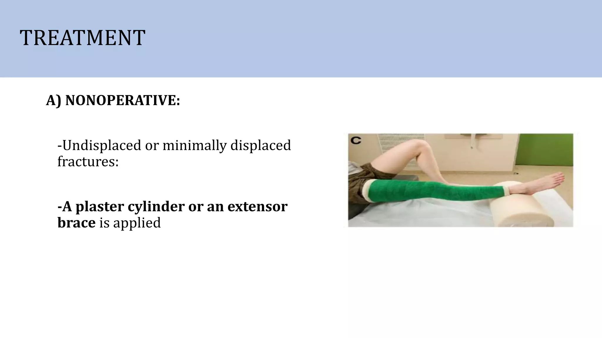 DISTAL FEMUR, PATELLA, PROXIMAL TIBIA FRACTURE.pptx